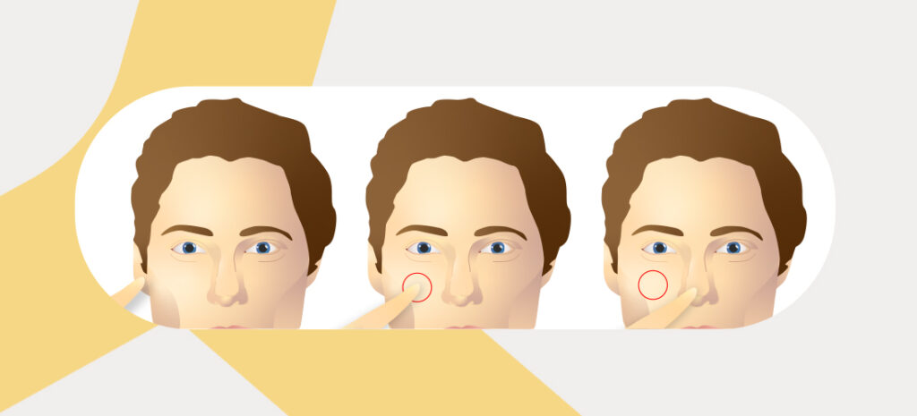 High vs. Low Cheekbones: How to Tell the Difference | Mewing.coach High vs. Low Cheekbones: How to Tell the Difference | Mewing.coach