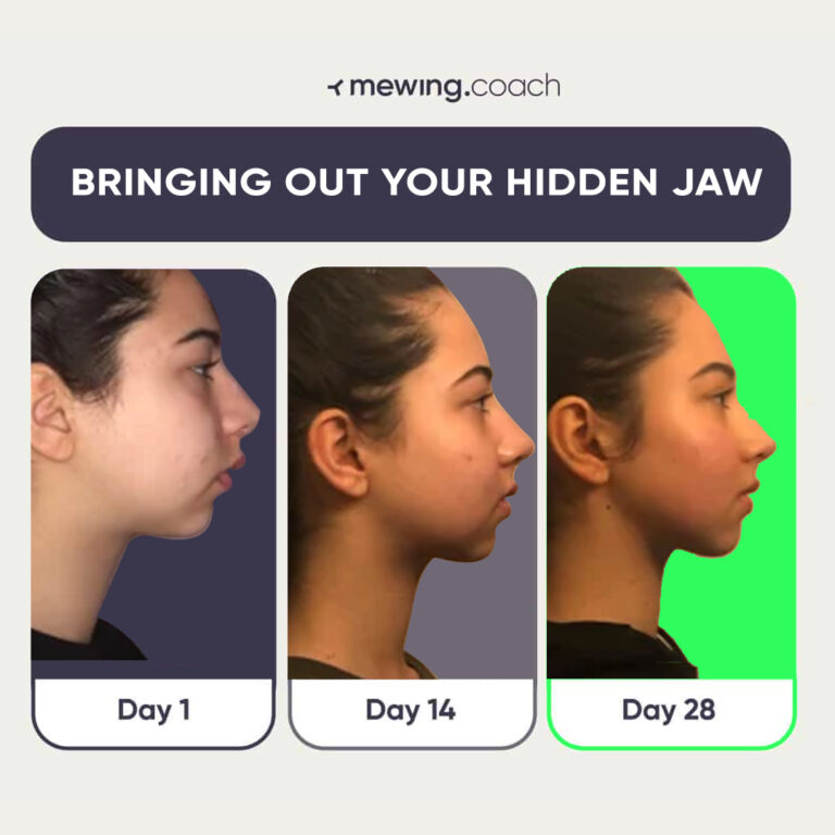 Are Jawlines Genetic or Can You Shape Them? | Mewing.coach