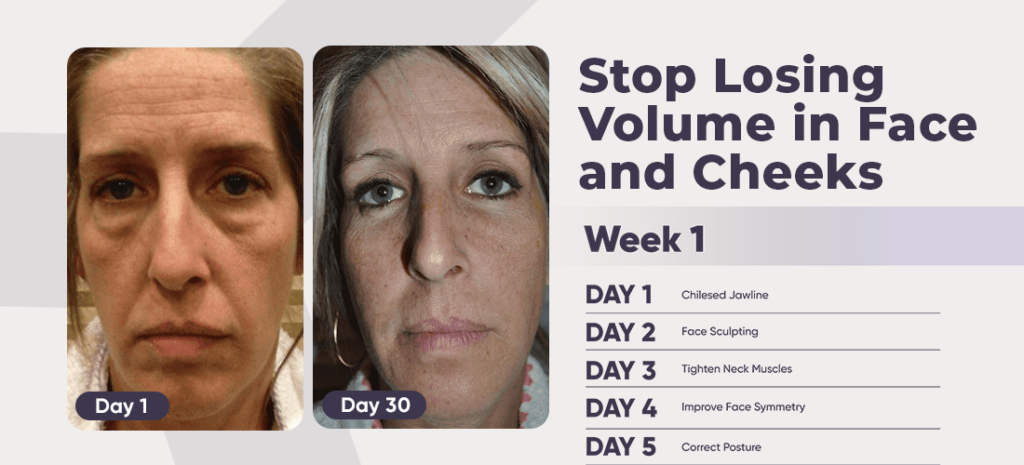 Gaunt Face: 4 Ways to Stop Losing Volume in Face and Cheeks | Mewing.coach