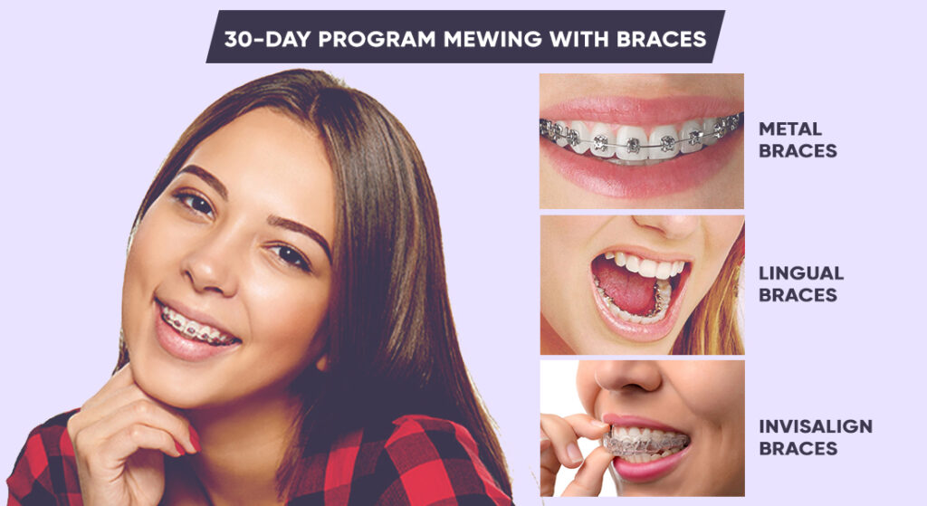 Mewing With Braces: When Does it Work Best? | Mewing.coach