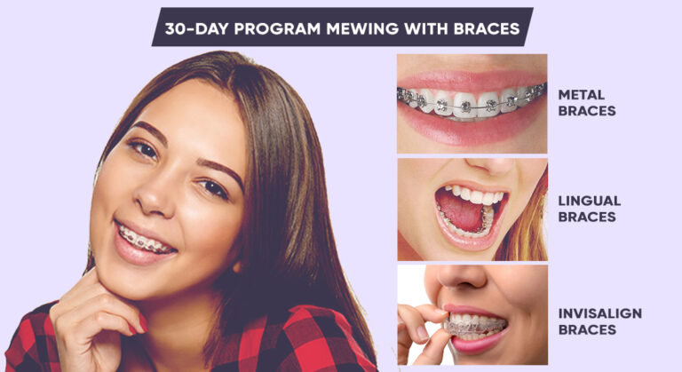 Mewing With Braces: When Does it Work Best? | Mewing.coach