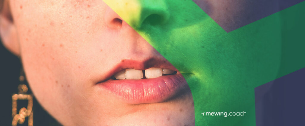 Open Mouth Posture: Causes, Risks and Treatment | Mewing.coach