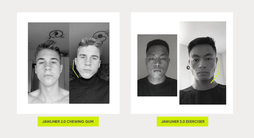 Does Chewing Gum Help Jawline Lets Check The Facts Ach