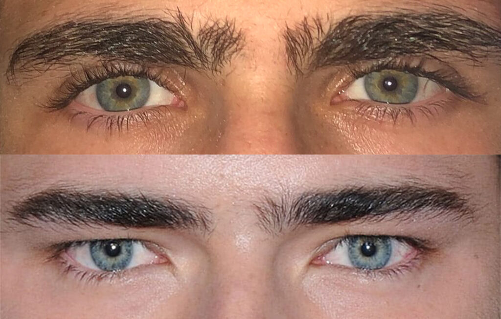 Hunter Eyes: How To Get Them Naturally With Exercises | Mewing.coach