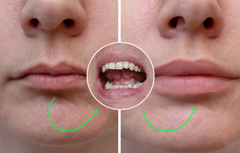 Mewing Guide: 8 Steps to Success (+How To Video & Diagram) | Mewing.coach