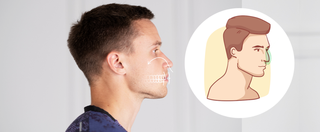 Mewing Guide: 8 Steps to Success (+How To Video & Diagram) | Mewing.coach