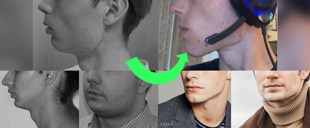 Mewing Guide: 8 Steps to Success (+How To Video & Diagram) | Mewing.coach