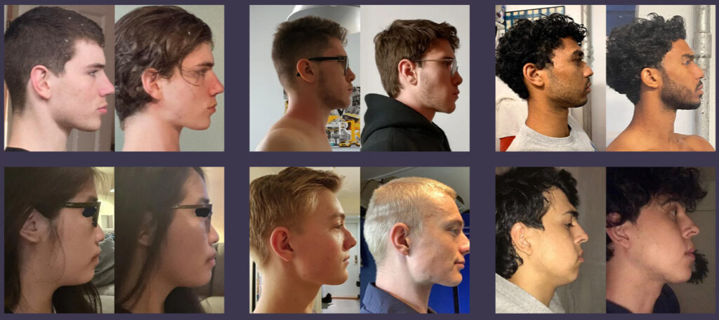 Mewing Guide: 8 Steps to Success (+How To Video & Diagram) | Mewing.coach