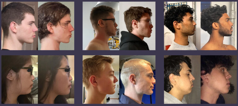 Mewing Guide: 8 Steps to Success (+How To Video & Diagram) | Mewing.coach