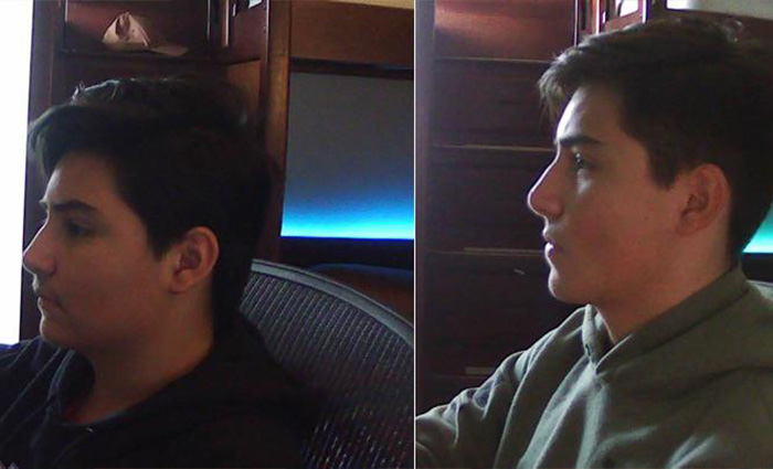 Mewing Before & After Results: 70+ Crazy Transformations