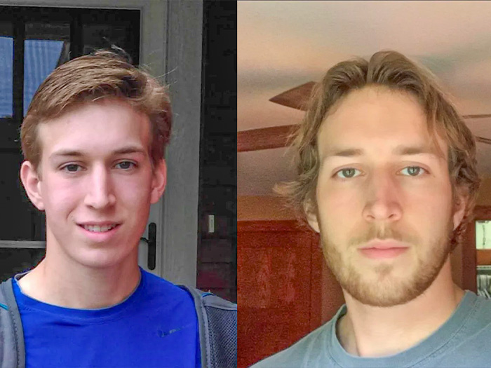 Mewing Before & After Results: 70+ Crazy Transformations