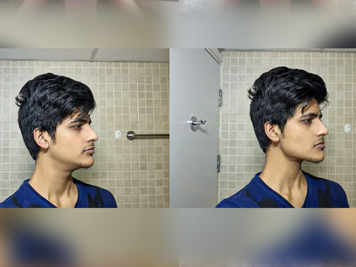 Mewing Before & After Results: 70+ Crazy Transformations