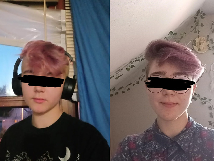 Mewing Before & After Results: 70+ Crazy Transformations